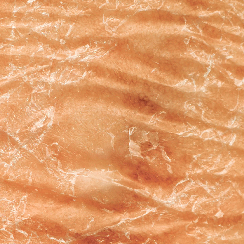 Xerosis: causas, consecuencias y soluciones | BIODERMA